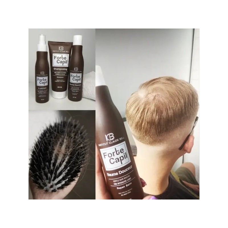 Full Anti-Hair Loss Treatment Routine with Vitamins by FORTE CAPIL