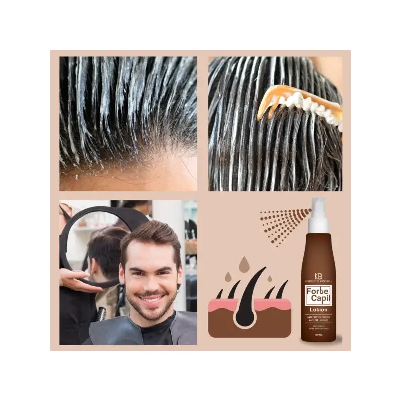 New Year s Sale FORTE CAPIL Anti hair Loss Hair Regrowth Full Set